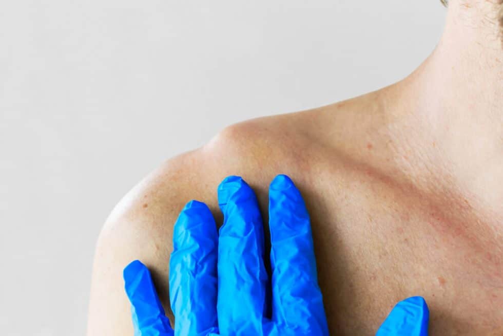 Physio for Shoulder Injury | Miami Physiotherapy